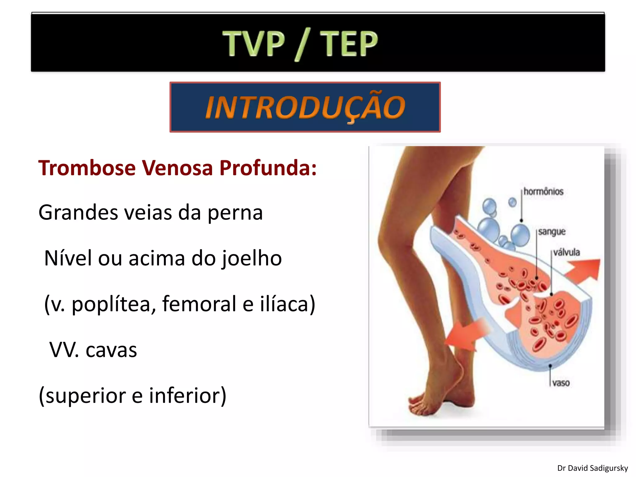 Aula Trombose Venosa Profunda (TVP) - Ortopedia | PPTX