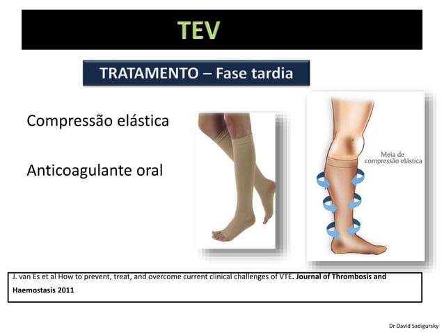 Aula Trombose Venosa Profunda (TVP) - Ortopedia