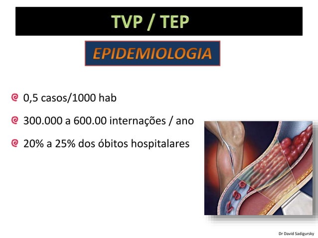Aula Trombose Venosa Profunda (TVP) - Ortopedia