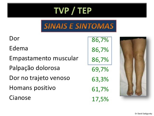 Aula Trombose Venosa Profunda (TVP) - Ortopedia
