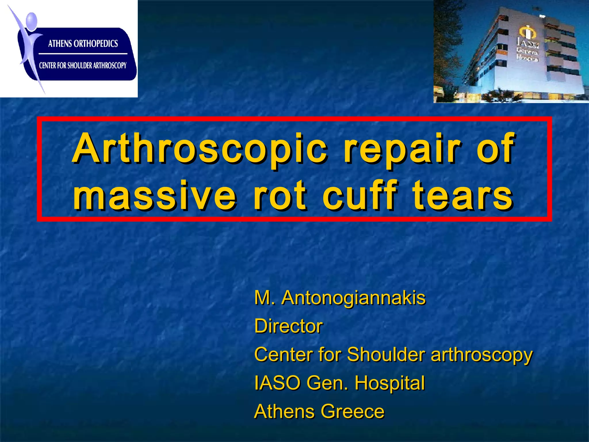 Massive rot cuf | PPT