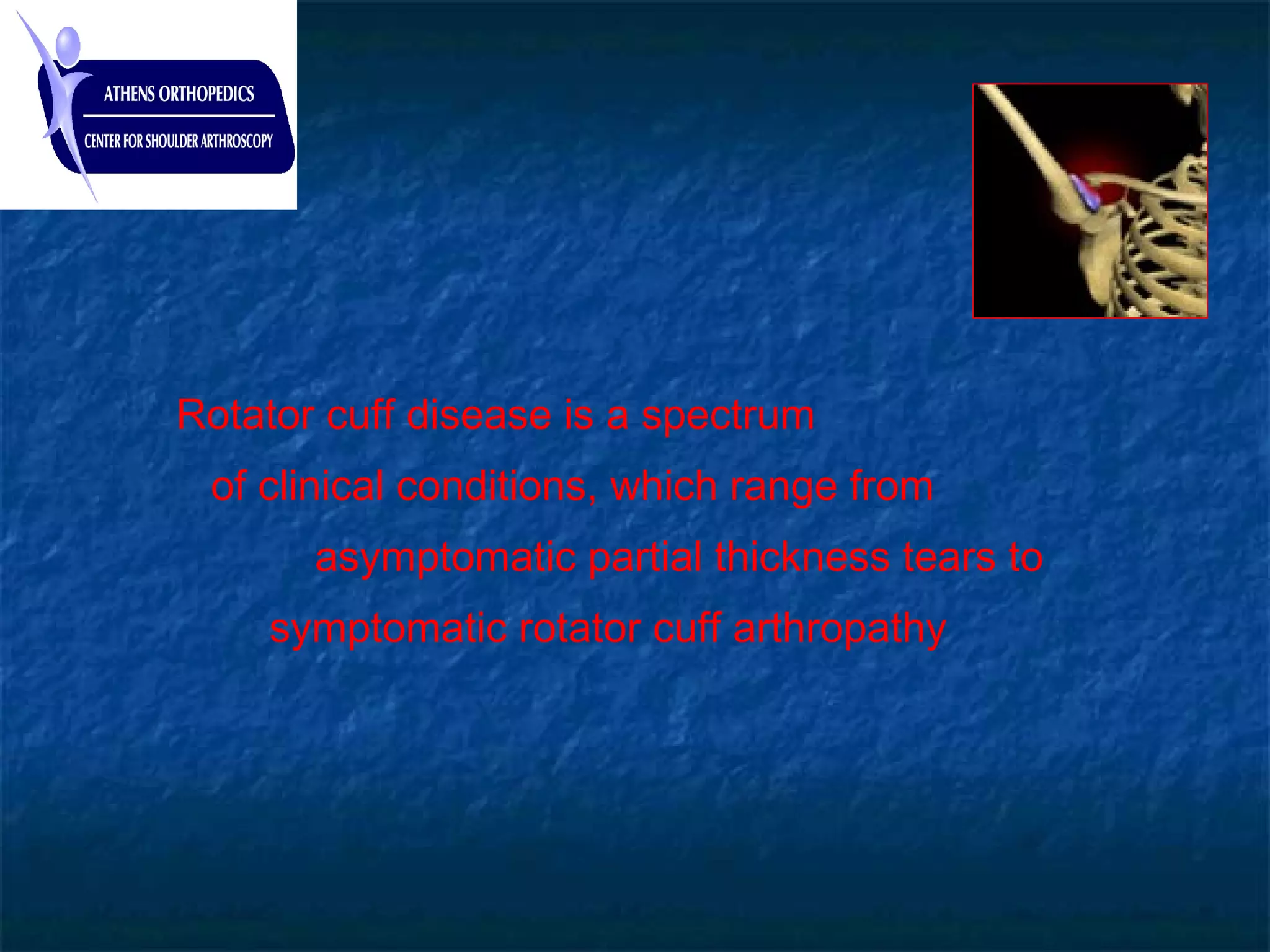 Massive rot cuf | PPT