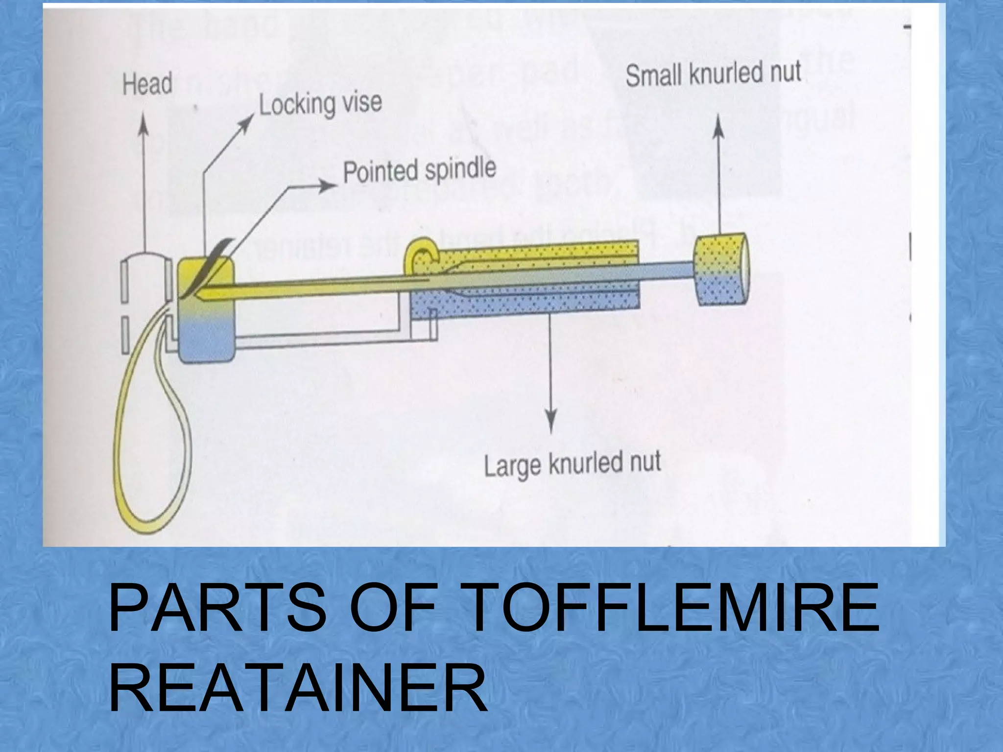 Types Of Matrix Retainer & Parts Of Retainer | PPT