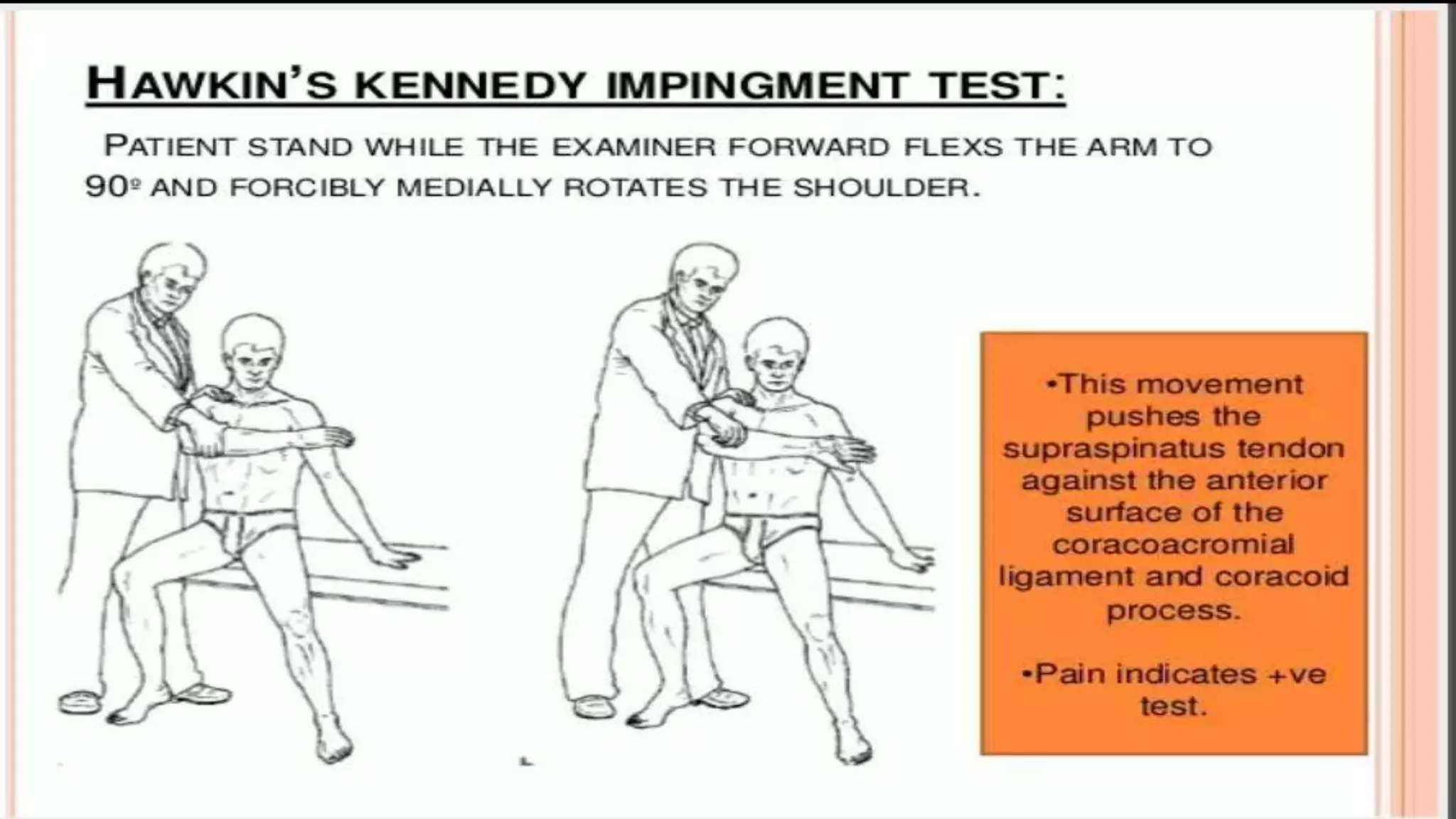 shoulder assessment (full) | PPTX