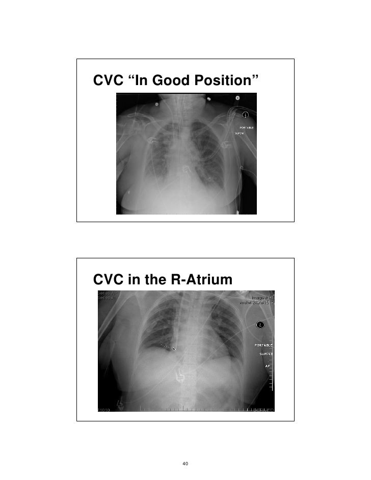 Syllabus adv crtcresres_hemodynamics_03-04-08
