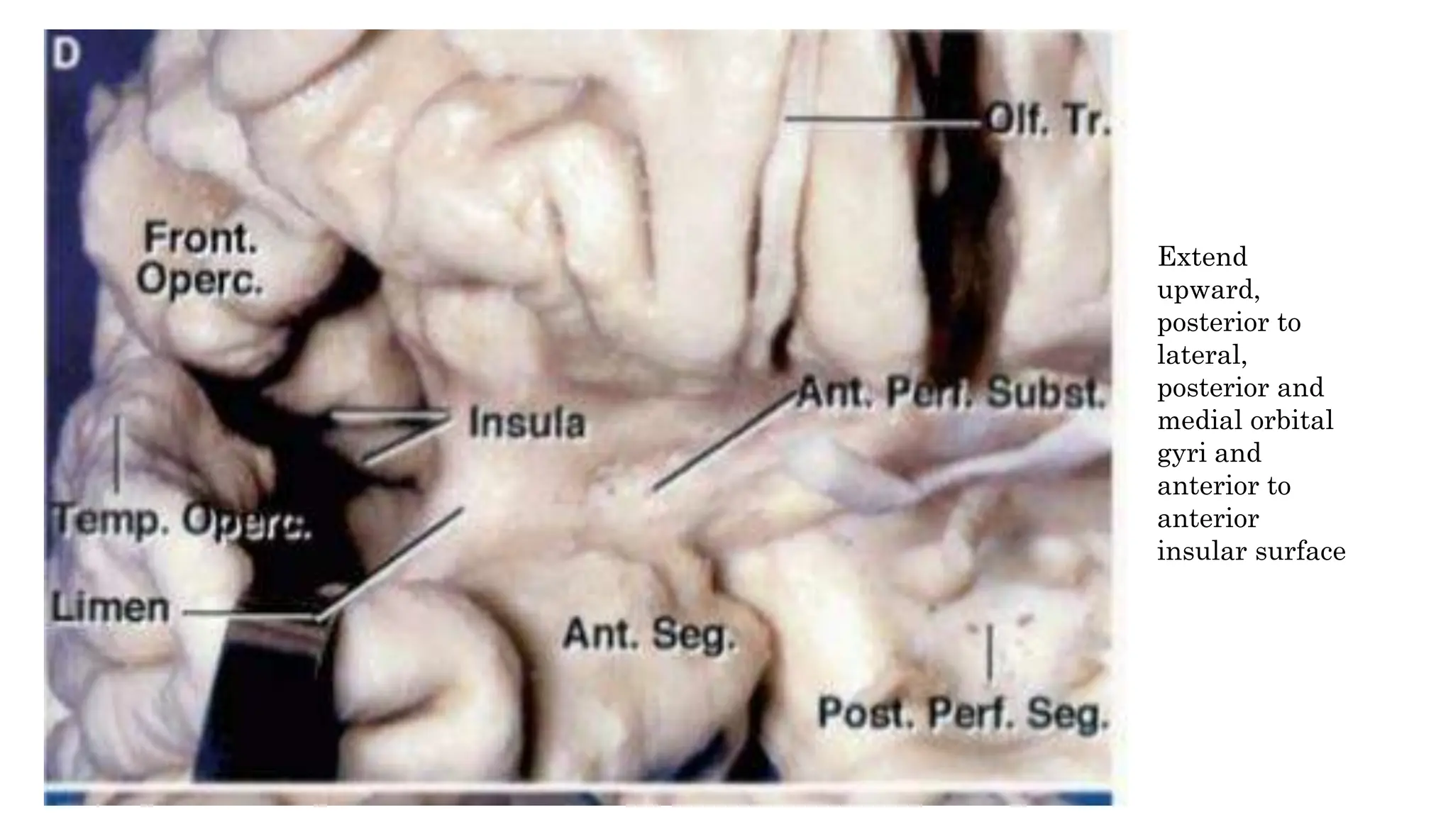Sylvain fissure Neuro surgical Anatomy and corridors | PPTX