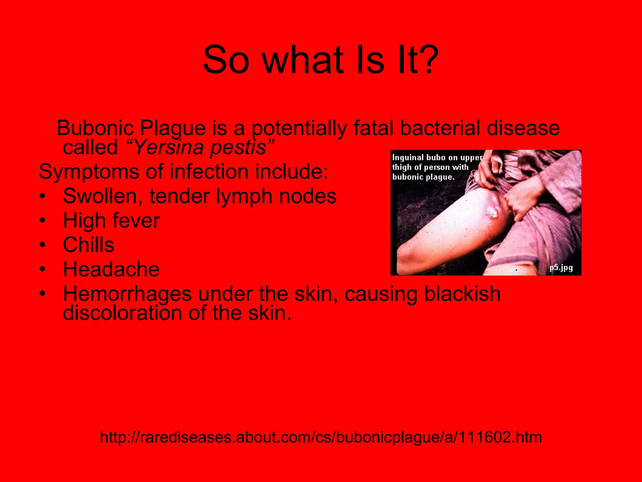 Sylvatic Plague | PPT | Infectious Diseases | Diseases and Conditions