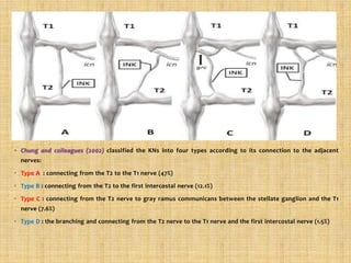 Sympathectomy | PPTX