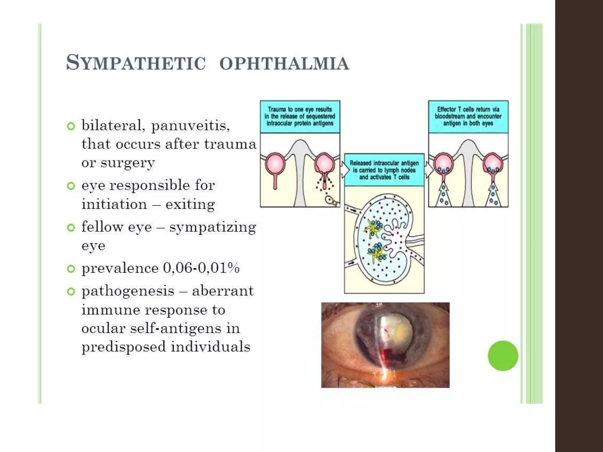 Sympathetic ophthalmitis | PPTX
