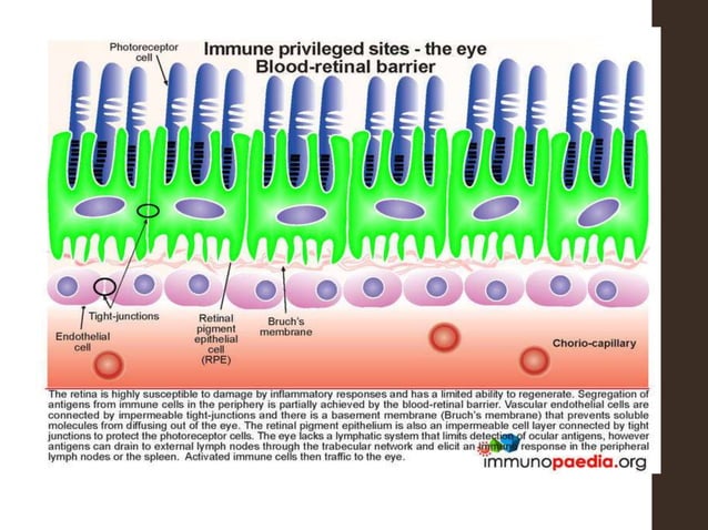 Sympathetic ophthalmitis | PPTX