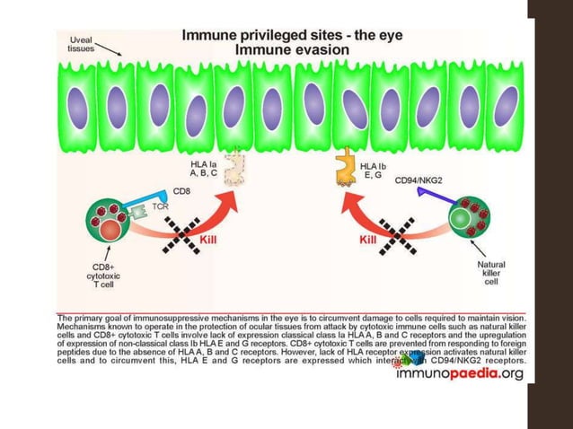 Sympathetic ophthalmitis | PPTX