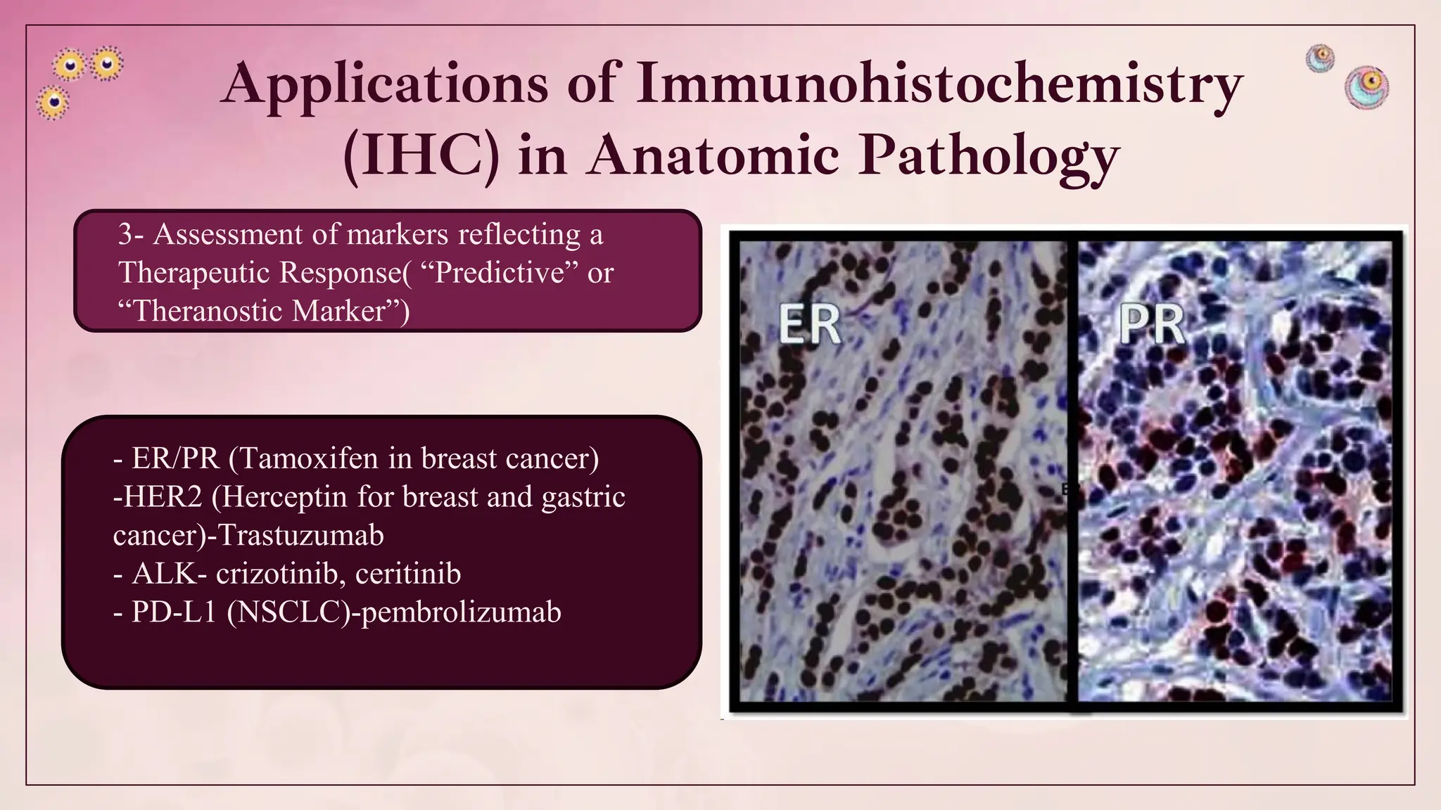 IHC in cancer diagnosis | PPTX