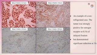IHC in cancer diagnosis | PPTX