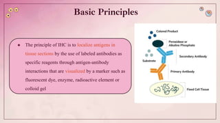 IHC in cancer diagnosis | PPTX