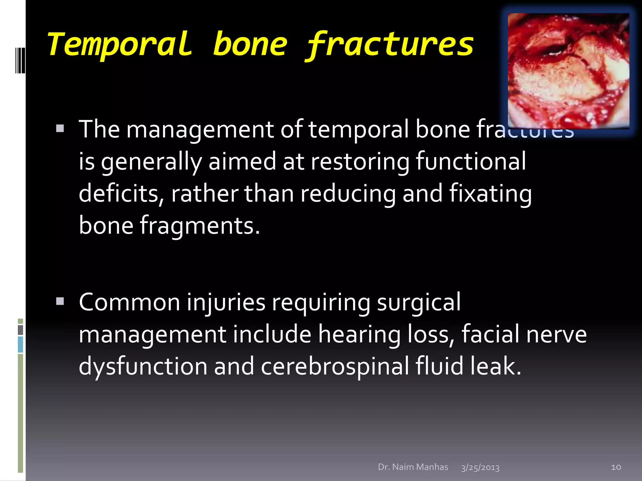 temporal bone fractures | PPTX