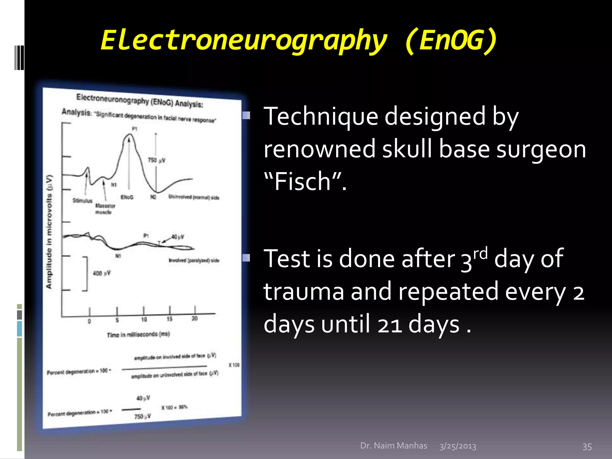 temporal bone fractures | PPTX