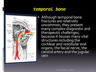 temporal bone fractures | PPTX