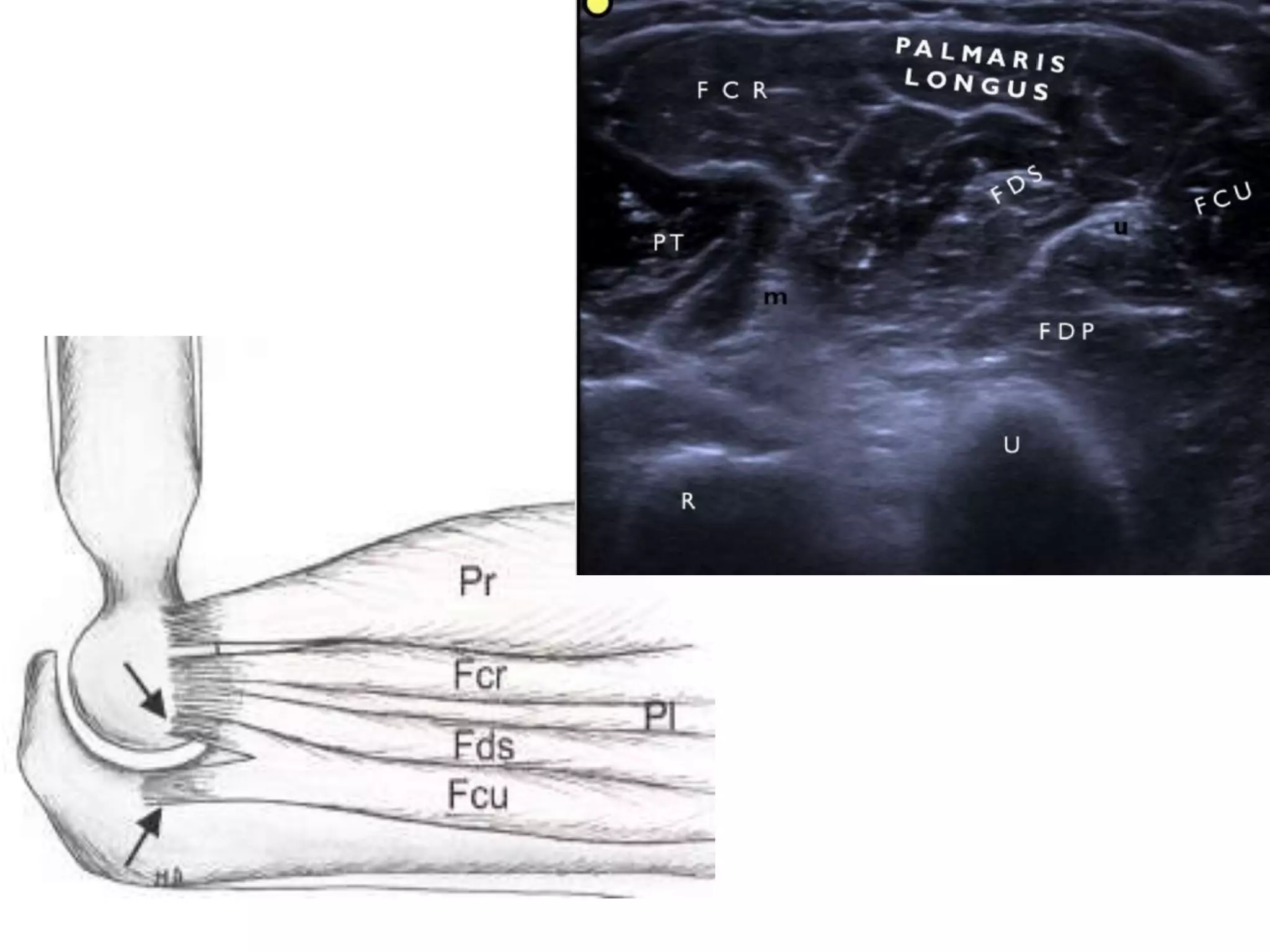 Ultrasound Guided Botulinum Toxin Injection and Nerve Block for ...