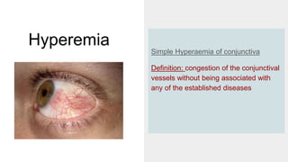 Symptomatic conditions of conjunctiva | PPT