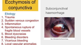 Symptomatic conditions of conjunctiva | PPT