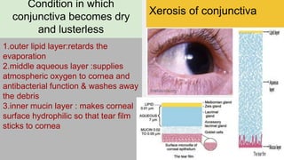 Symptomatic conditions of conjunctiva | PPT