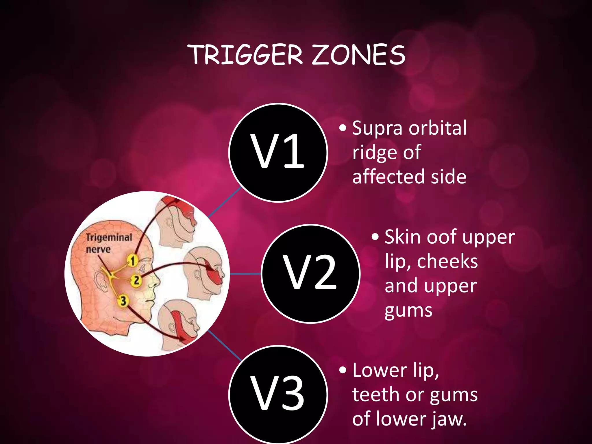 Symptomatology and pathophysiology of trigeminal neuralgia copy | PPTX