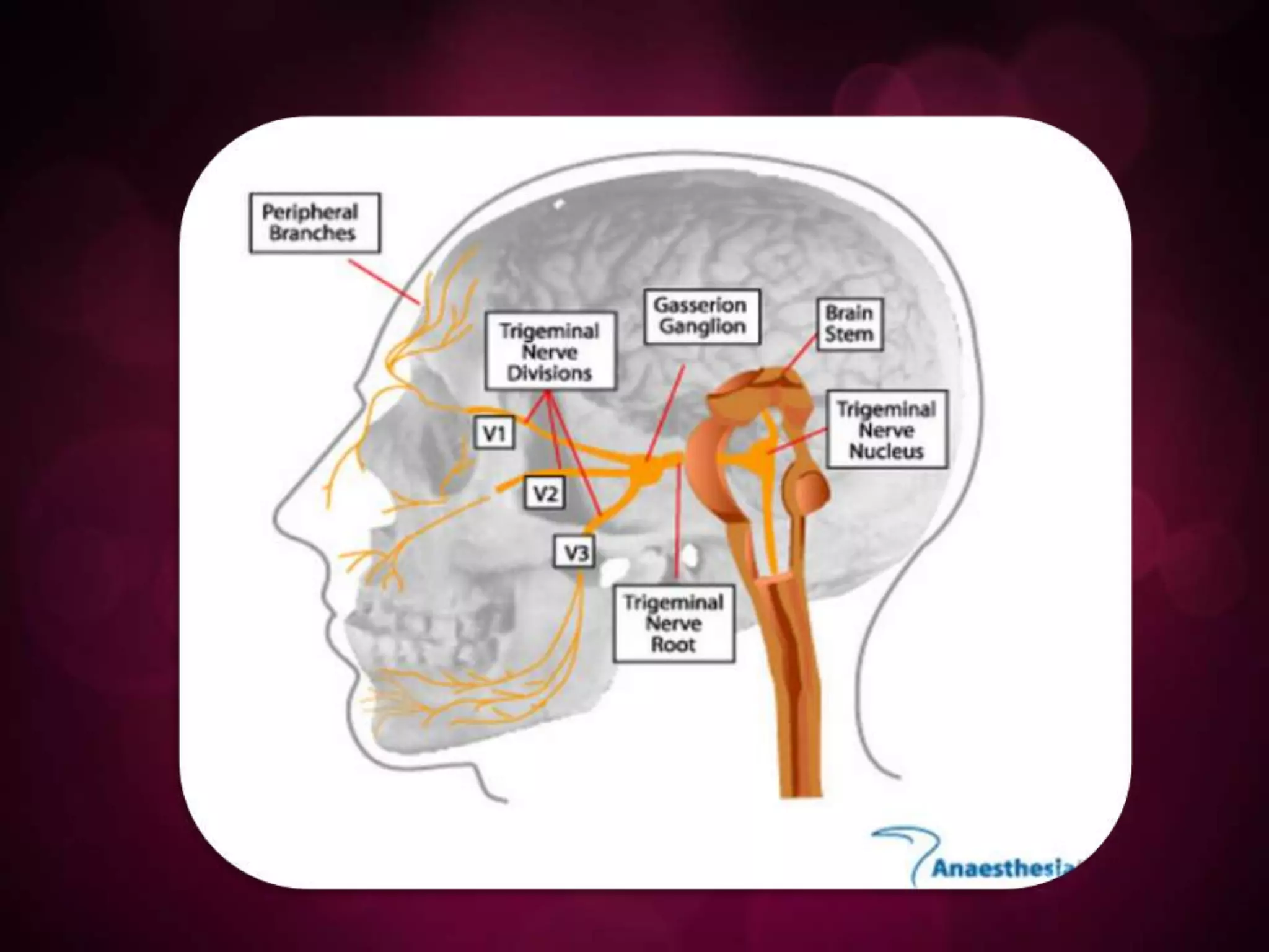 Symptomatology and pathophysiology of trigeminal neuralgia copy | PPTX