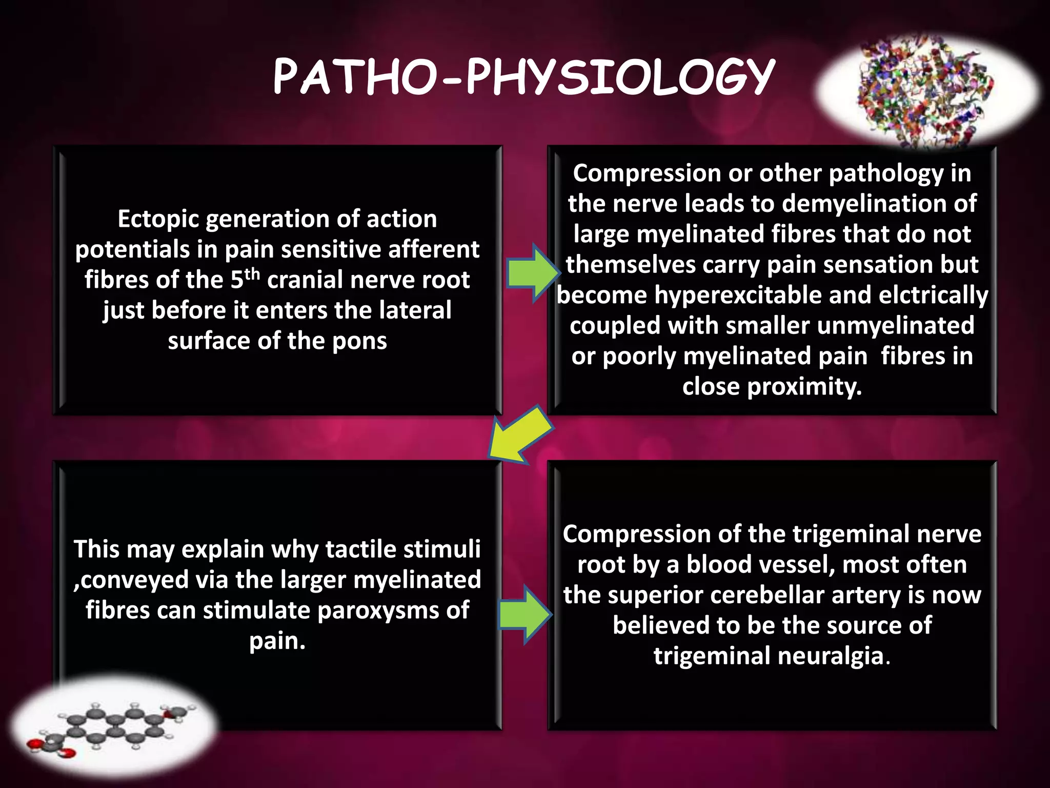 Symptomatology and pathophysiology of trigeminal neuralgia copy | PPTX