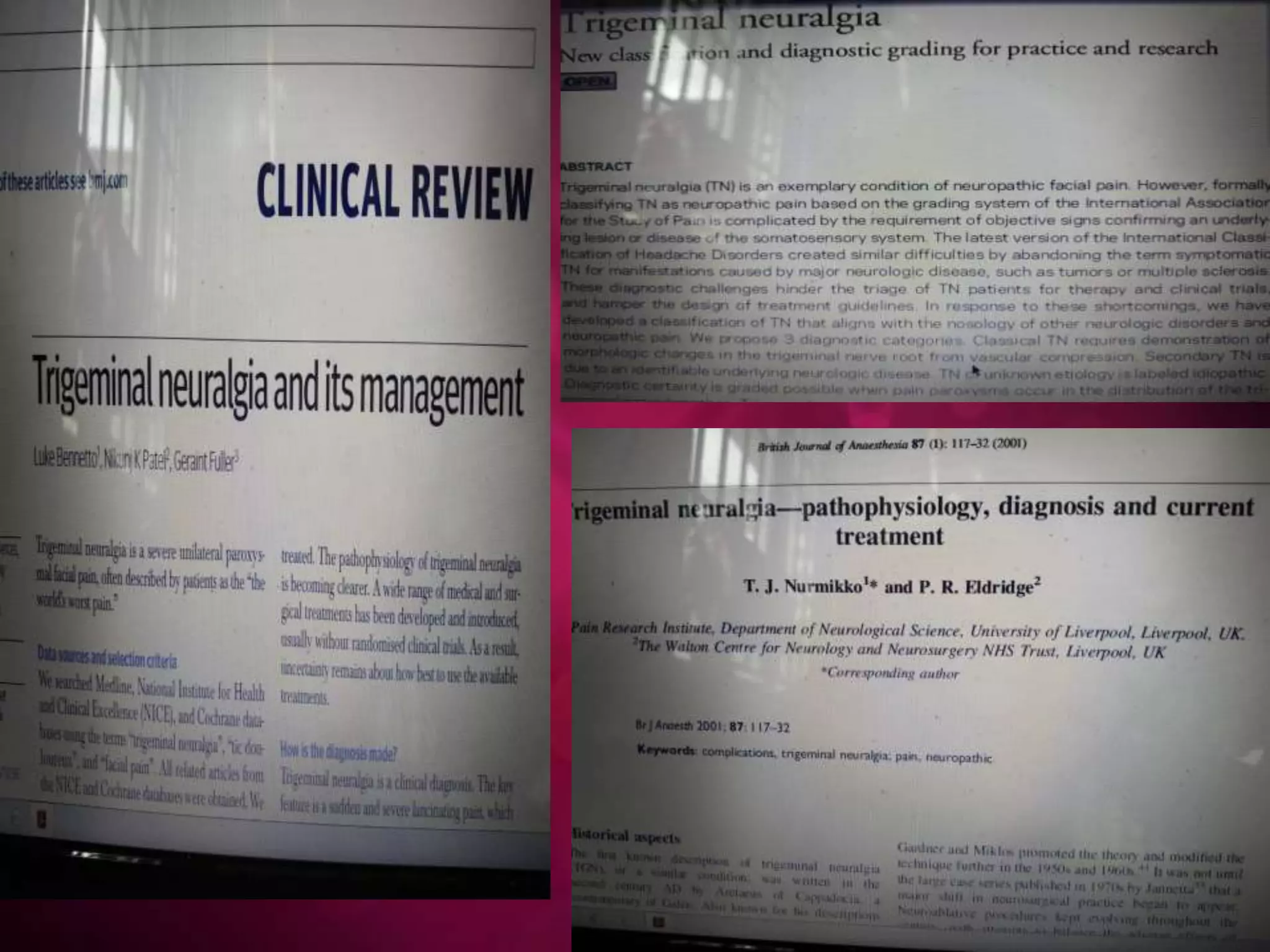 Symptomatology and pathophysiology of trigeminal neuralgia copy | PPTX