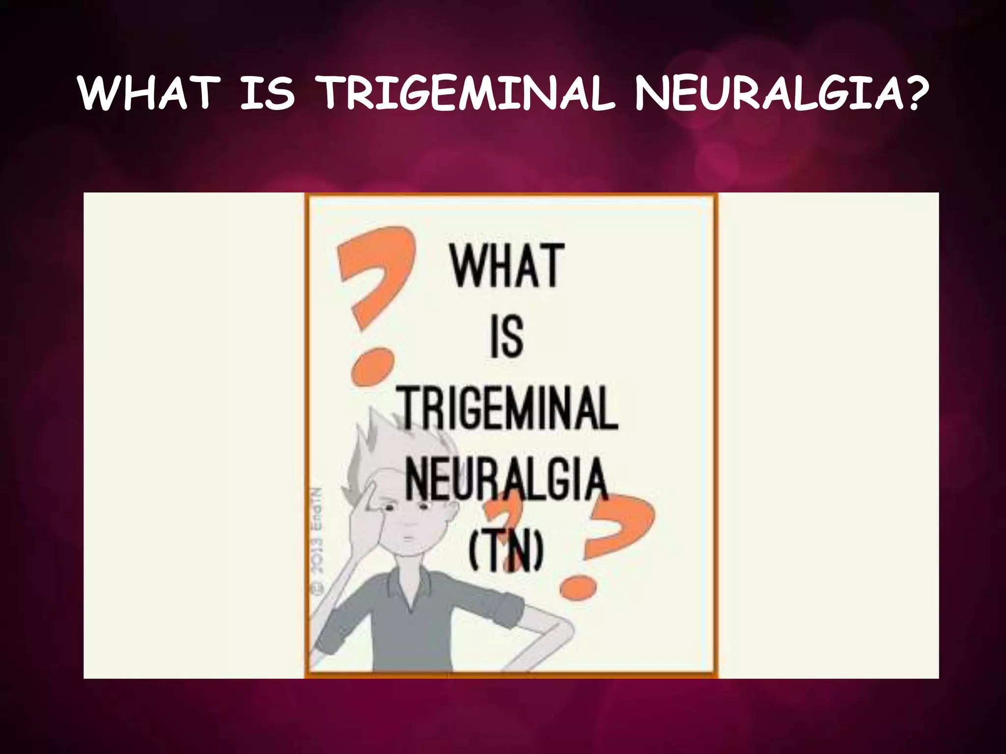 Symptomatology and pathophysiology of trigeminal neuralgia copy | PPTX