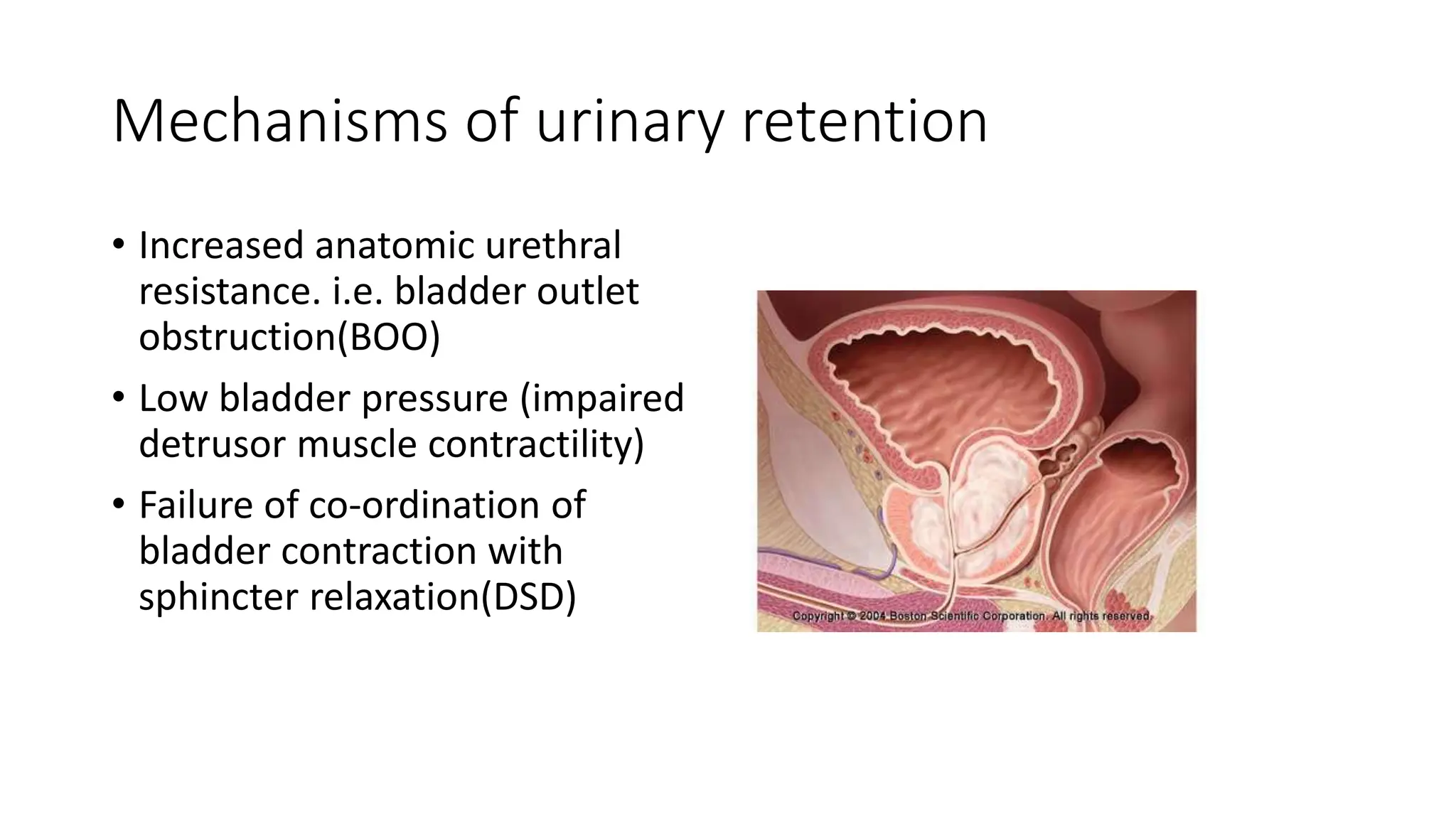 Signs And Symptoms Of Genitourinary Diseases 20diseasespptx