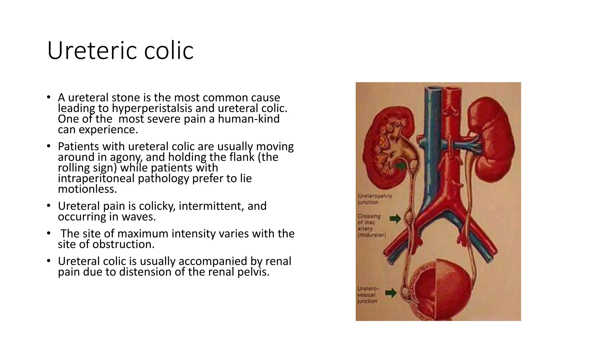 Signs and Symptoms of Genitourinary diseases 20Diseases.pptx