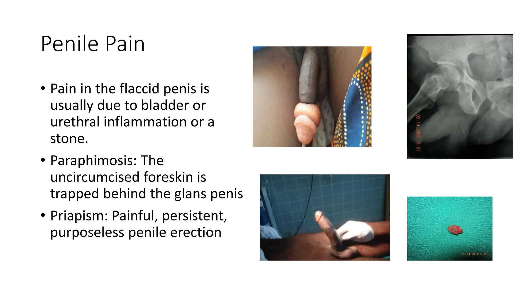 Signs And Symptoms Of Genitourinary Diseases 20diseasespptx