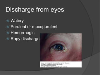 Symptoms in ophthalmology | PPTX