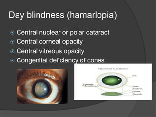 Symptoms in ophthalmology............... | PDF