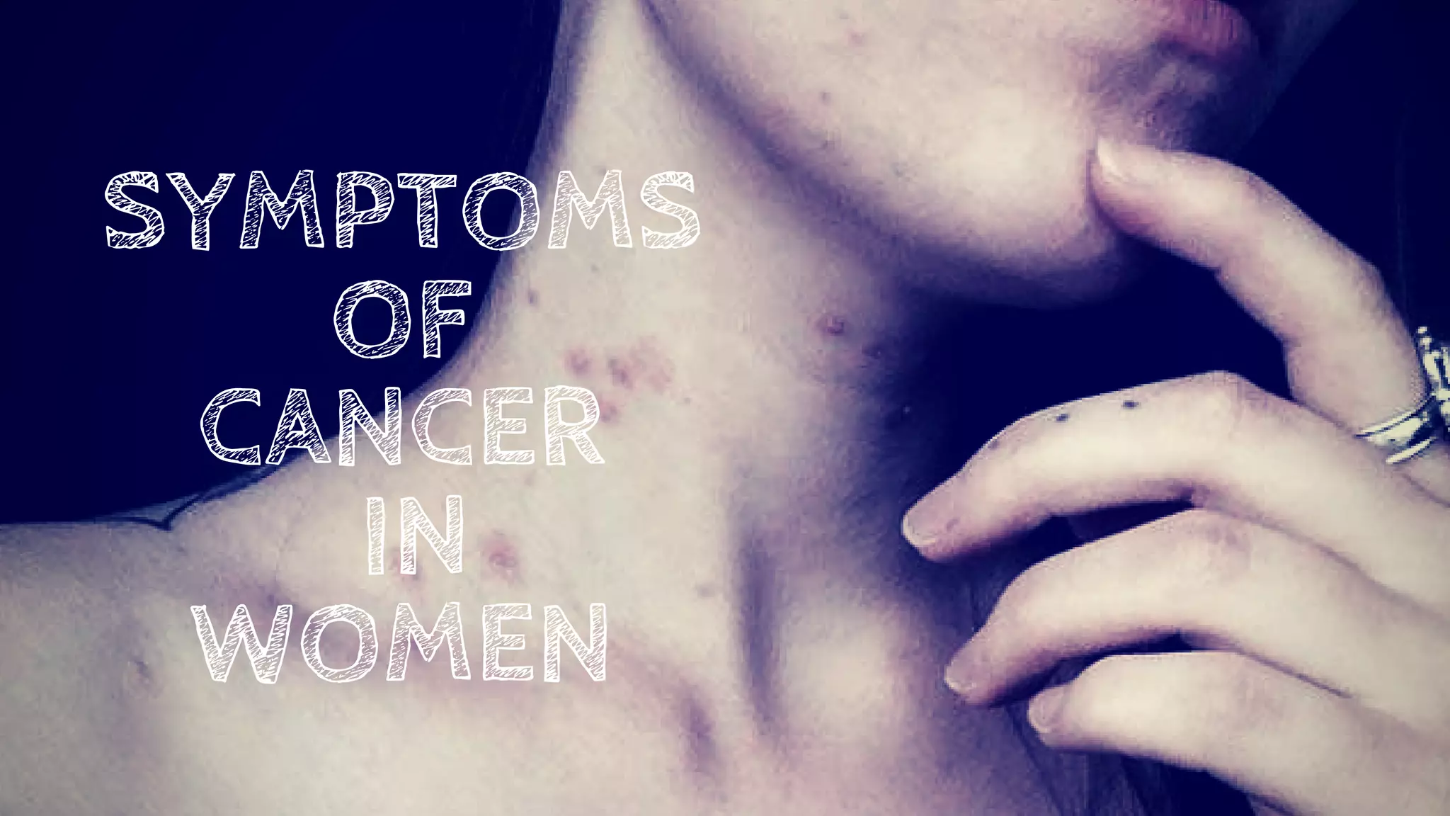 Symptoms of cancer in women | PPT