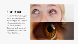 Eye Infection Symptoms You Shouldn't Ignore | PPTX