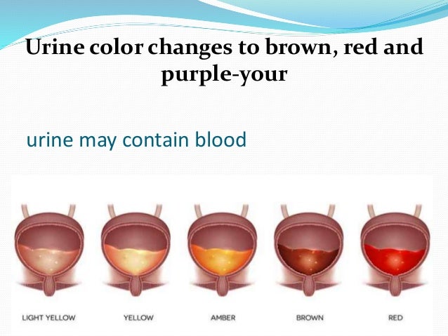 Sign and Symptoms Of Kidney Failure