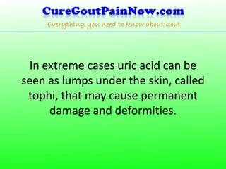 Symptoms Of Gout | PDF