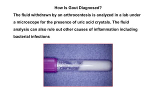 Symptoms of gout | PPT