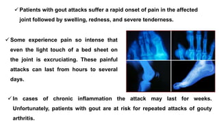 Symptoms of gout | PPTX