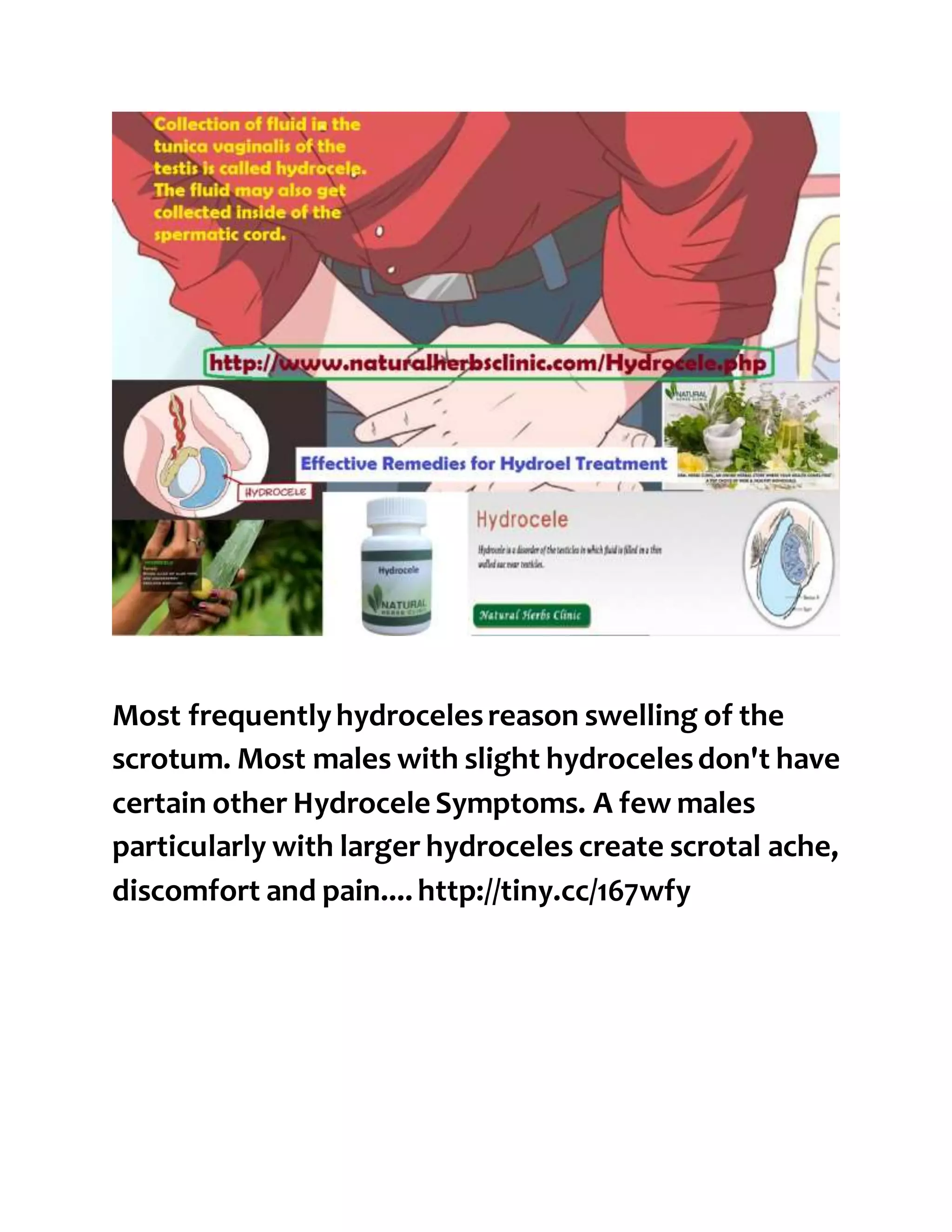 Symptoms of hydrocele | PDF