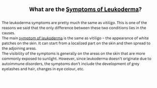 Symptoms of Leukoderma.pdf