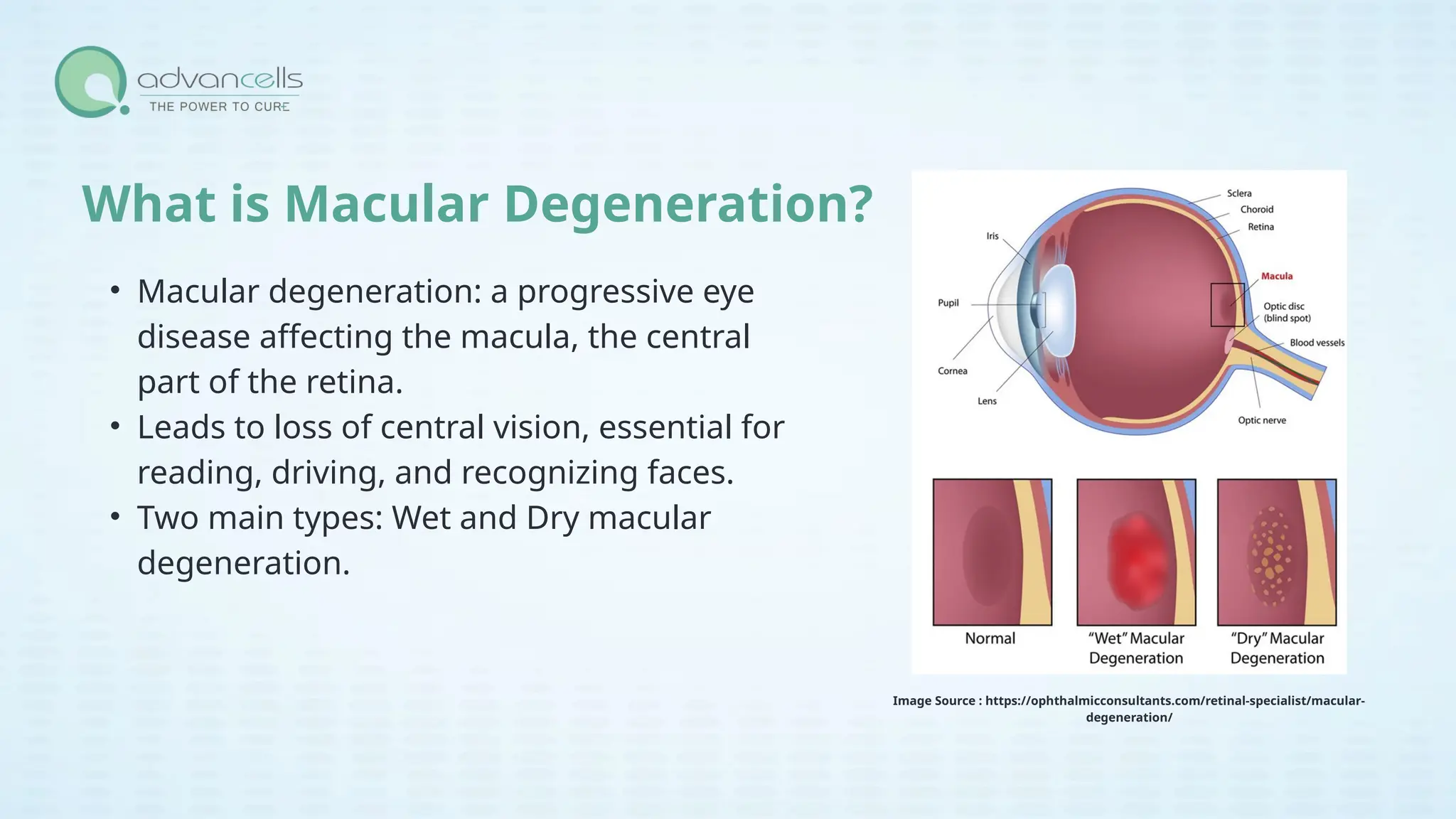 Symptoms of Macular Degeneration and Age-Related Macular Degeneration | PPTX