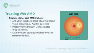 Symptoms of Macular Degeneration and Age-Related Macular Degeneration ...