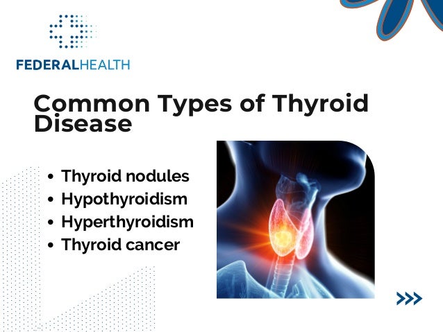 What are thyroid problems symptoms? | PDF