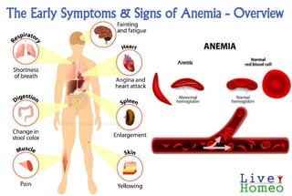 Symptoms & Sign Of Anemia | PDF