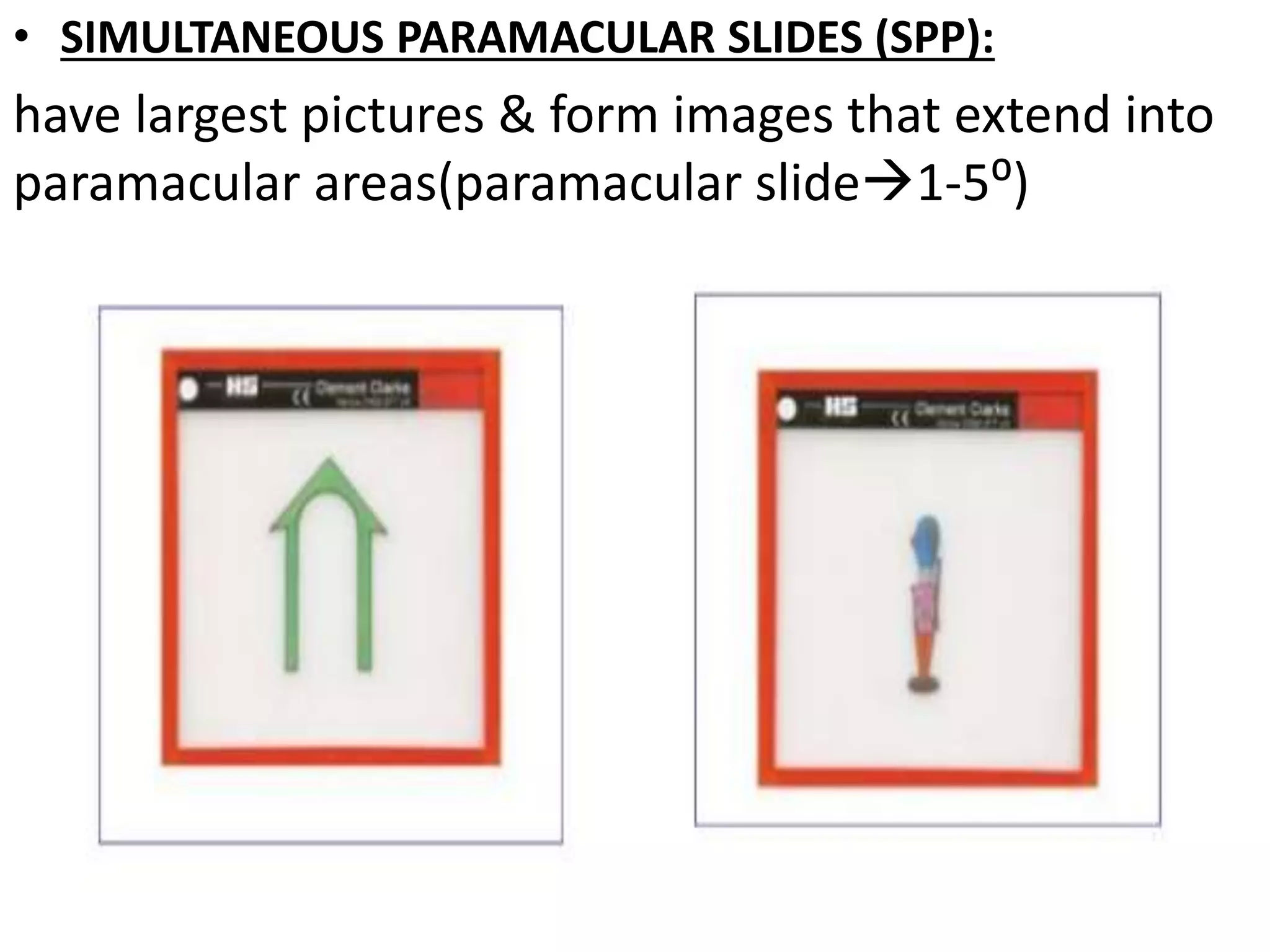 Synaptophore in ophthalmology | PPTX