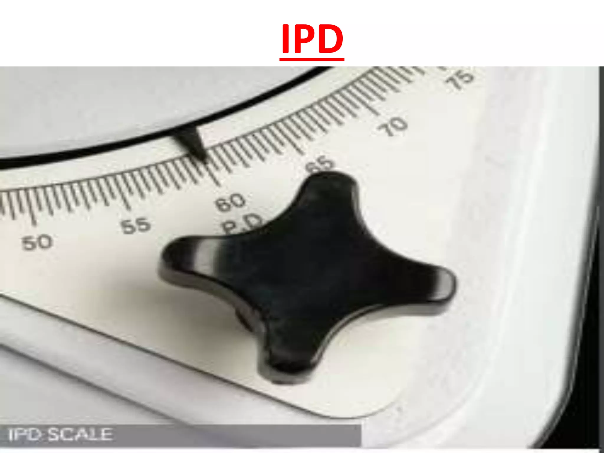 Synaptophore in ophthalmology | PPTX