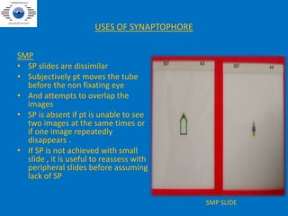 SYNAPTOPHORE.pptx
